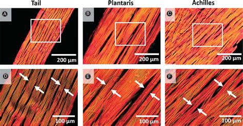 Picrosirius Red Staining Revisiting Its Application To The 42 Off