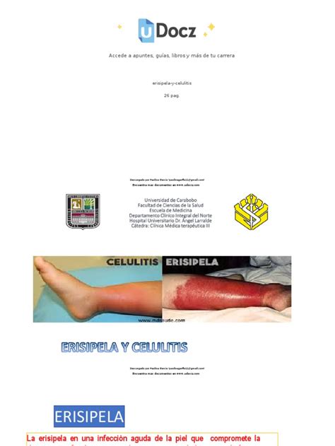 Erisipela Y Celulitis 146465 Downloable 1385017 Pdf Microbiología