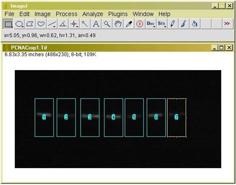 Using ImageJ Figure The University Of Queensland Image Processing Helpful