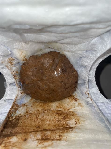 Diaper Poop Ball Cum Explosion Rmessydiaperss