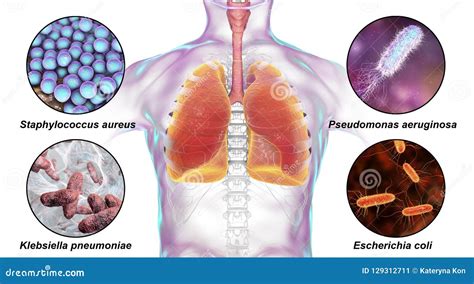 Respiratory Pathogens Bacteria Mycobacterium Tuberculosis And