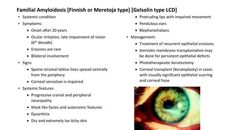 Corneal Dystrophy Pptx