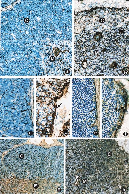 Analysis Of Thymic Microenvironment Components Of Human Neonatal