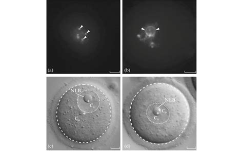 Classification Of Mouse Gv Oocytes A B By Chromatin Configuration Download Scientific