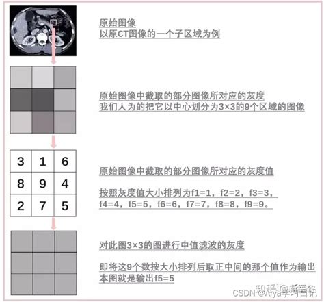 医学影像知识（二）：医学影像常见数据预处理方式 医学图像预处理 csdn博客