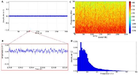 Basal Electrocorticographic Tracing N 9 A Ecog Signal Obtained