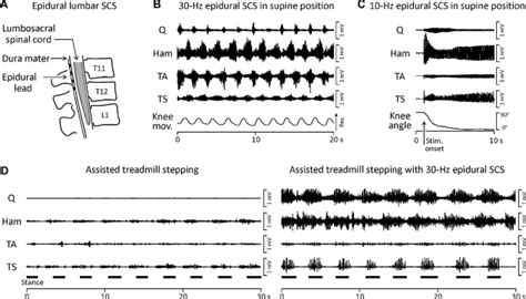 Lower Limb Motor Activity Generated By Epidural Lumbar Scs A Drawing