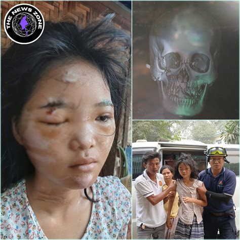 News ကြက်ဥရောင်းရင်း ငလျှင်လှုပ်ချိန် နံရံပိသွားခဲ့တဲ့ ၁၄ နှစ်အရွယ