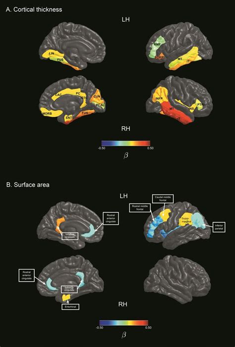 Cortical Features Selected Using Regularised Regression Models Colour Download Scientific