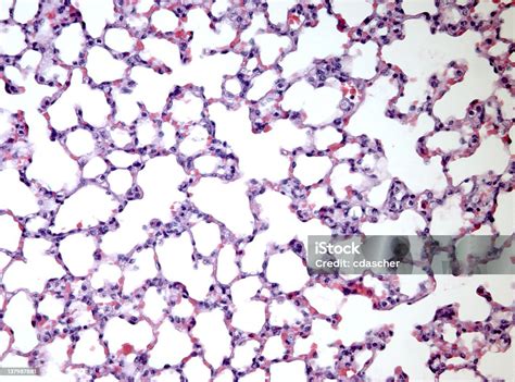 Bagian Jaringan Paruparu Foto Stok Unduh Gambar Sekarang Alveolus