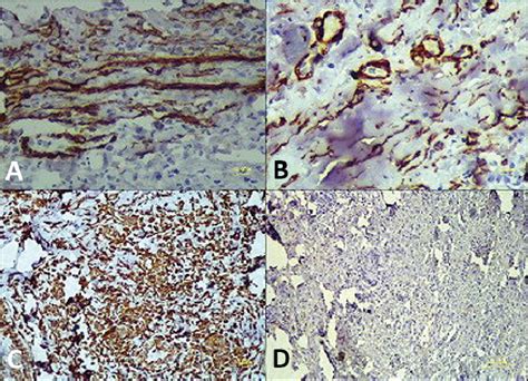 immunohistochemical micrographs of the repaired ureters resected at 10