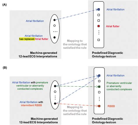 examples of an ecg interpretation syntax mapping in one to many