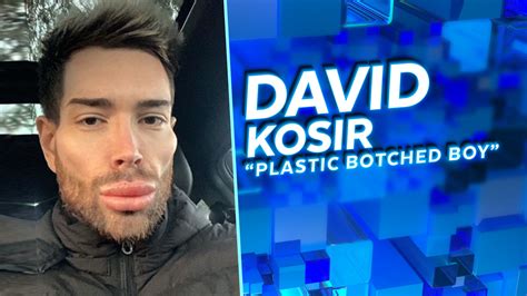 The More Plastic The More Fantastic David Kosir Spent 100 000 To Look Like A Ken Doll