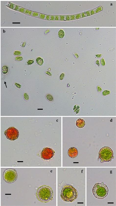 Morphological Diversity Of Microalgae And Cyanobacteria Of Cryoconite