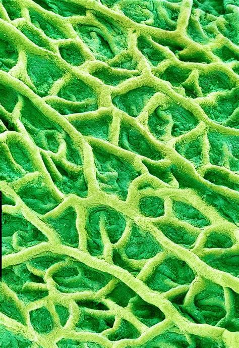 Gallbladder Surface Sem Stock Image C0215231 Science Photo Library