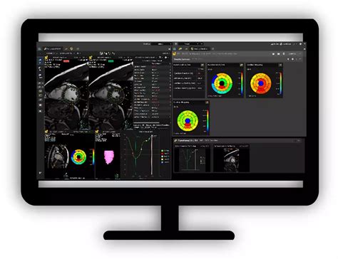 Philips Mr Cardiac Detailed Quantification Of Cardiac Function