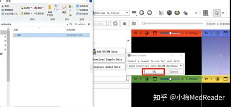 影像组学2：病灶分割 3d Slicer 知乎