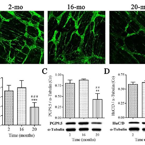 Diminished Enteric Neurons In The Colon Of Old Mice Pgp9 5 Recognized Download Scientific