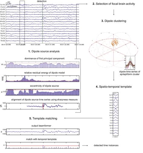 Figure 1 From Detection Of Focal Epileptiform Events In The Eeg By