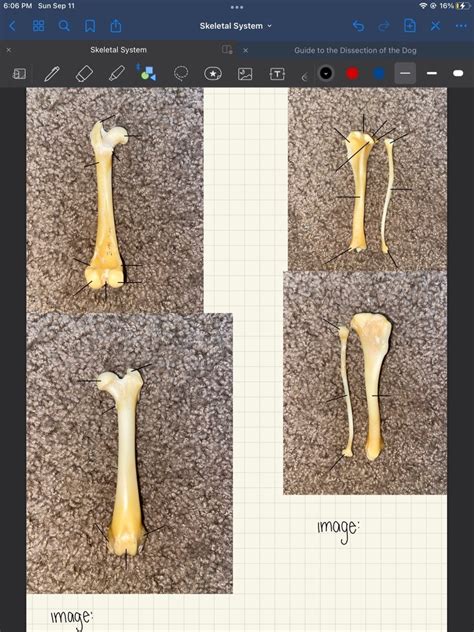 Femur Tibia Fibula Diagram Quizlet