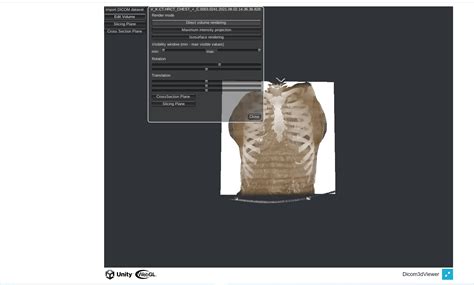 Webgl Output Error · Issue 125 · Mlavik1unityvolumerendering · Github