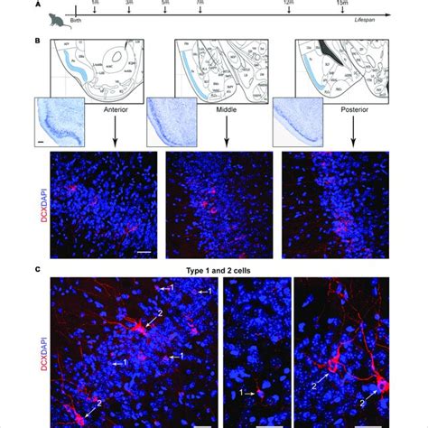 Analysis Of Layer Ii Cortical Immature Neurons Cins Of The Mouse Download Scientific Diagram