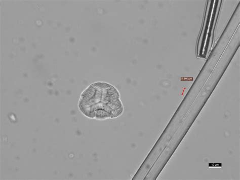 [coccoliths] Id Help