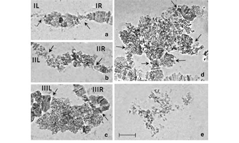 Centromeric Regions Of Three Polytene Elements Of R Cingulata A