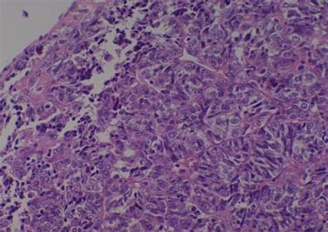 Novus Biologicals™ Human Ovary Tissue Microarray Cancer Slide Human Ovary Tissue Microarray