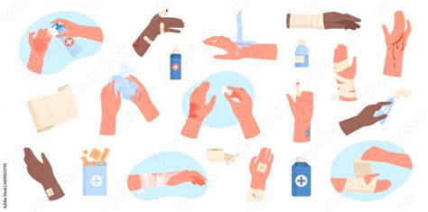 Injured Hands Set Vector Illustration Cartoon Isolated Human Arms With