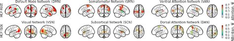 DBGSL Dynamic Brain Graph Structure Learning Paper And Code CatalyzeX