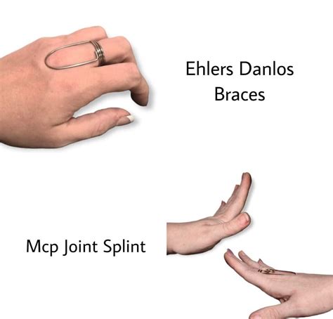 Arthritis Finger Mcp Joints Splint Brass Or Sterling Silver Etsy