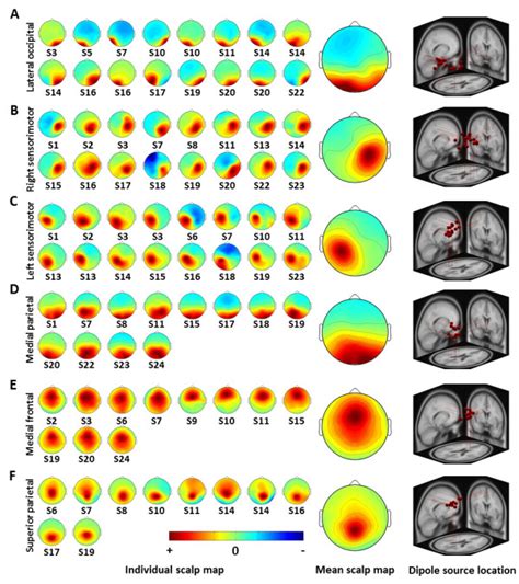 Scalp Maps And Dipole Source Locations Of Six Independent Component