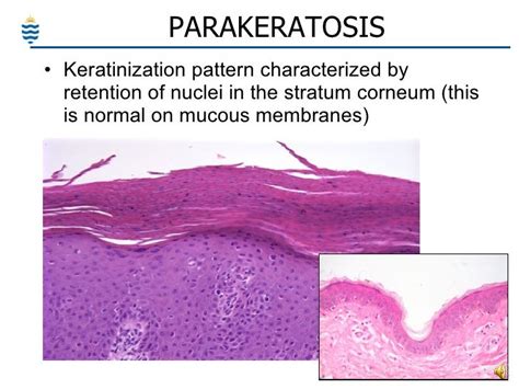 Pathology Of Skin Introduction