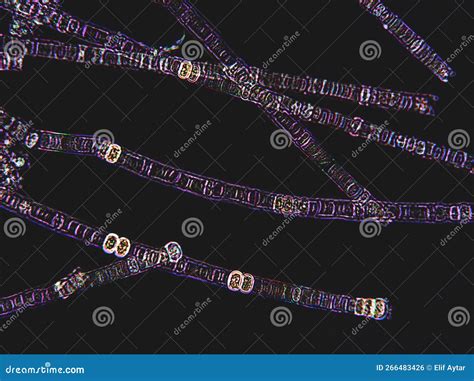Nodularia Sp Toxic Algae Under Microscopic View Nitrogen Fixing Cyanobacteria Cyanotoxin