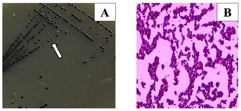 Targeting Nuc Gene For Detection Of Staphylococcus Aureus From Bovine Milk Samples Of Assam