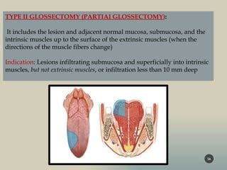 Tongue Its Anatomy Developmental Anomalies And Prosthodontic