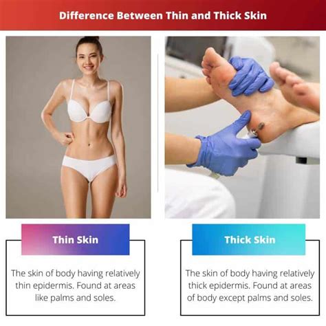 Thin Vs Thick Skin Difference And Comparison