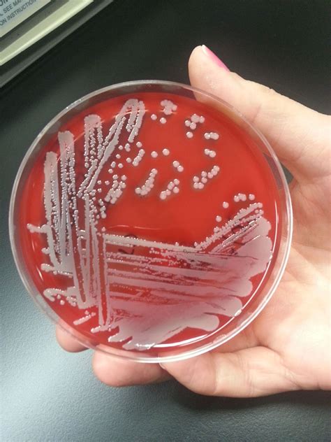 Staphylococcus Aureus Jpeg Microbiology Matters