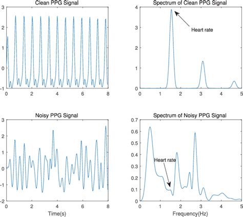 Figure 1 From Deepheart Semantic Scholar