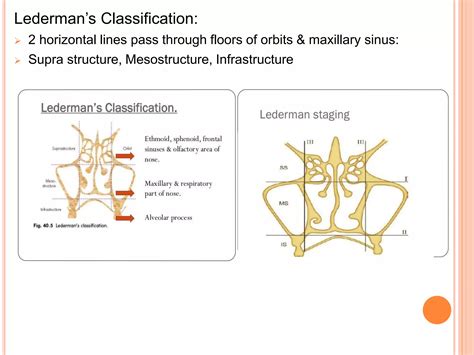 Sinunasal Malignacy Pptx