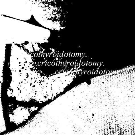 General Protocols Cricothyrotomy