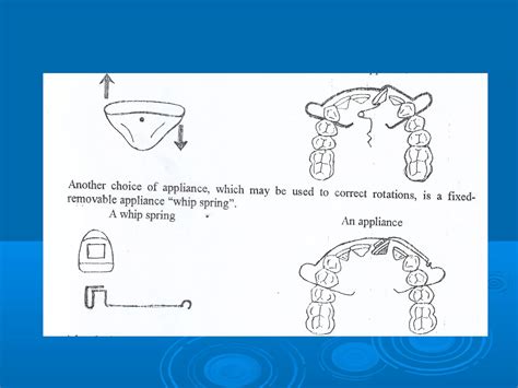 Treatment Of Crowding In Permanent Dentition Ppt