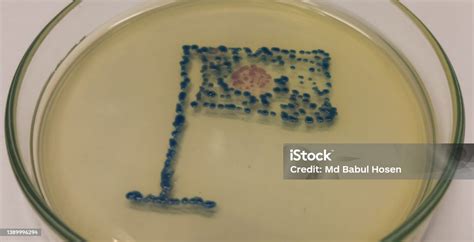 미생물학 실험실에서 Hicrome Uti 한천 배지에서 성장하는 박테리아 미생물 Enterobacter와 E Coli는 소변 샘플을 성장시킵니다 건강 진단에 대한 스톡 사진