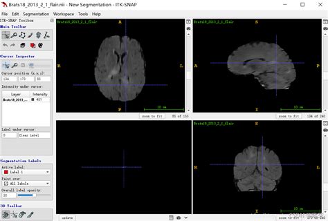 如何读取nifti格式图像(nii文件) Csdn博客 如何读取nifti格式图像(nii文件) Csdn博客