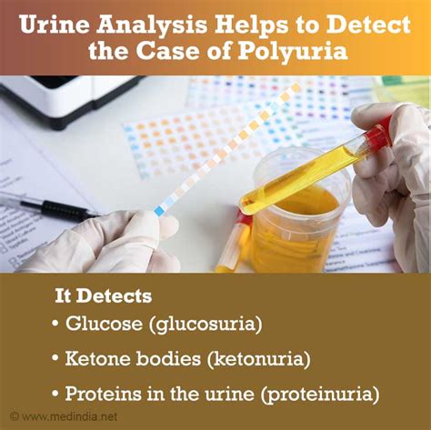 Polyuria Causes Symptoms Diagnosis Treatment Prevention