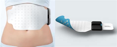 Body Surface Gastric Mapping To Determine Gastric Motility Patterns Associated With Delayed