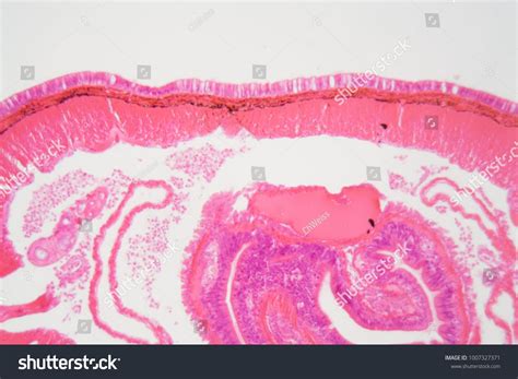 Cross Section Of An Earthworm Under The Ctioncrossmicroscopeearthworm
