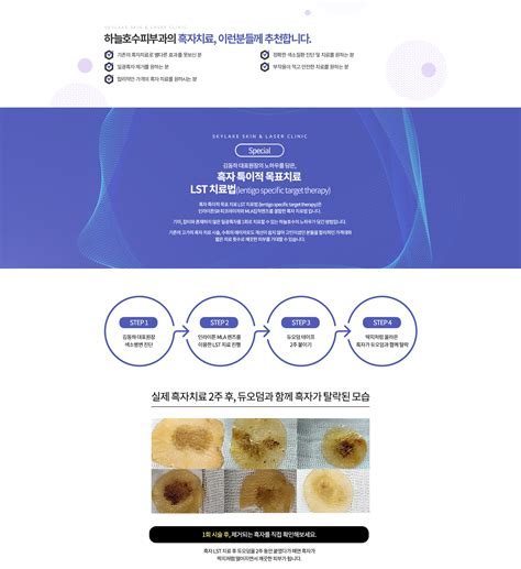 흑자치료 하늘호수피부과의원