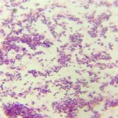 Gram Stain Of Anaerococcus Prevotii Download Scientific Diagram